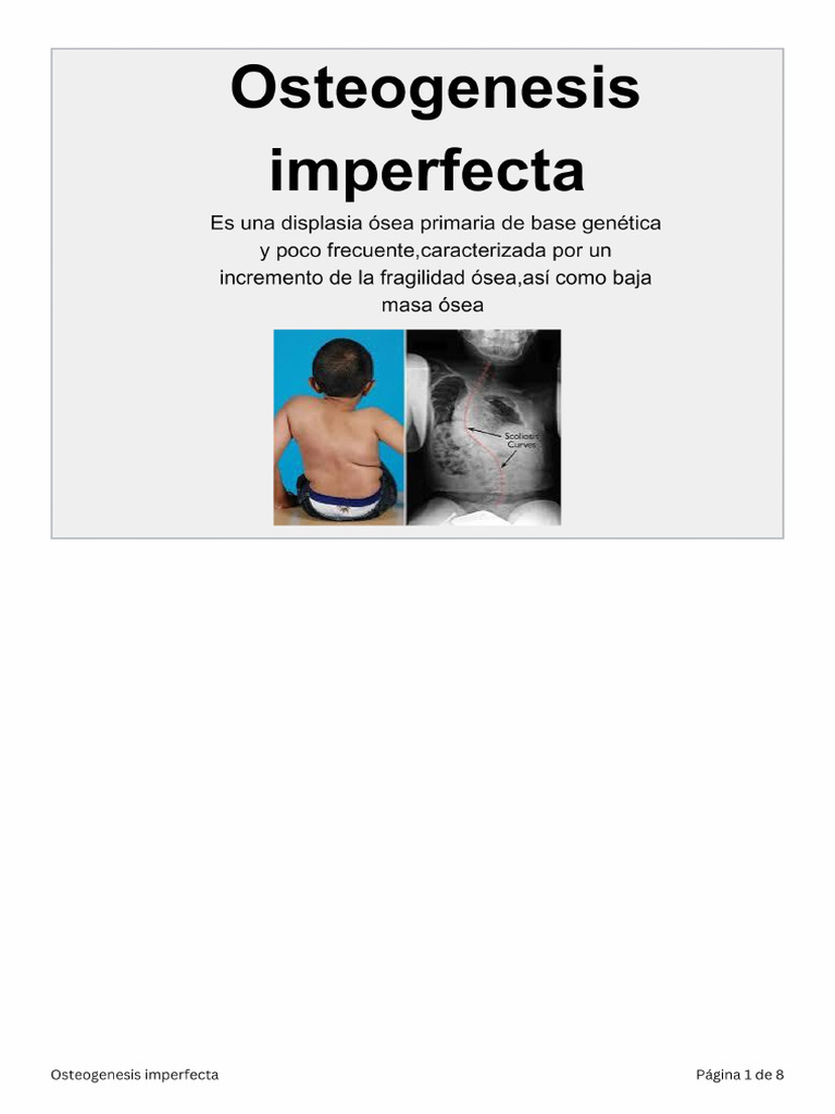 Osteogenesis Imperfecta - 20240619 - 210334 - 0000 | PDF