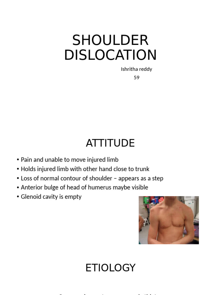 Shoulder Dislocation | PDF