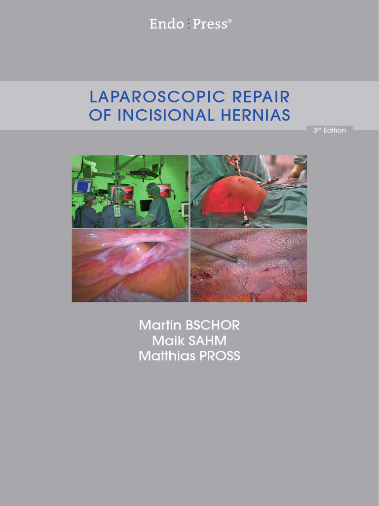 Lap Hernia Repair Procedure Step | PDF