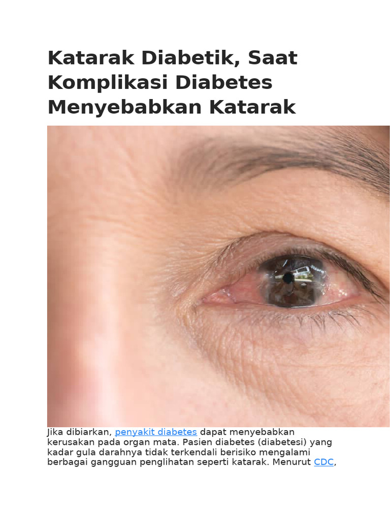 Katarak Diabetik | PDF