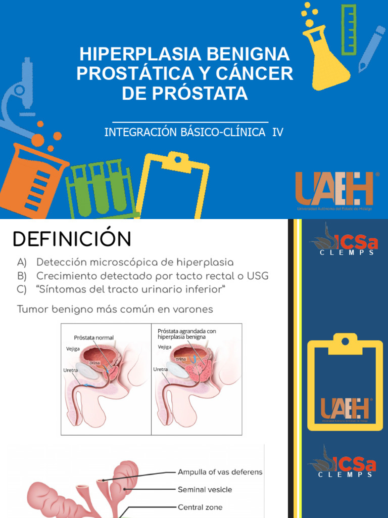 HBP Y CA DE PRÓSTATA | PDF