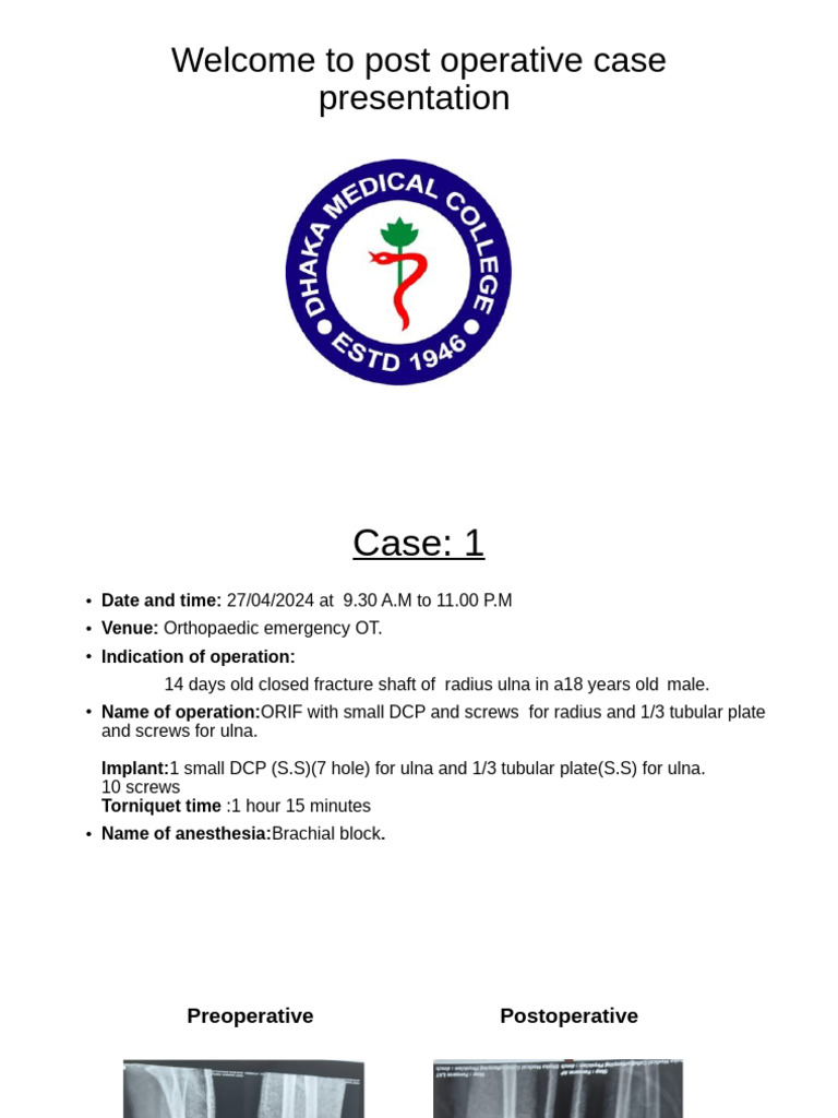 Welcome To Post Operative Case Presentation | PDF