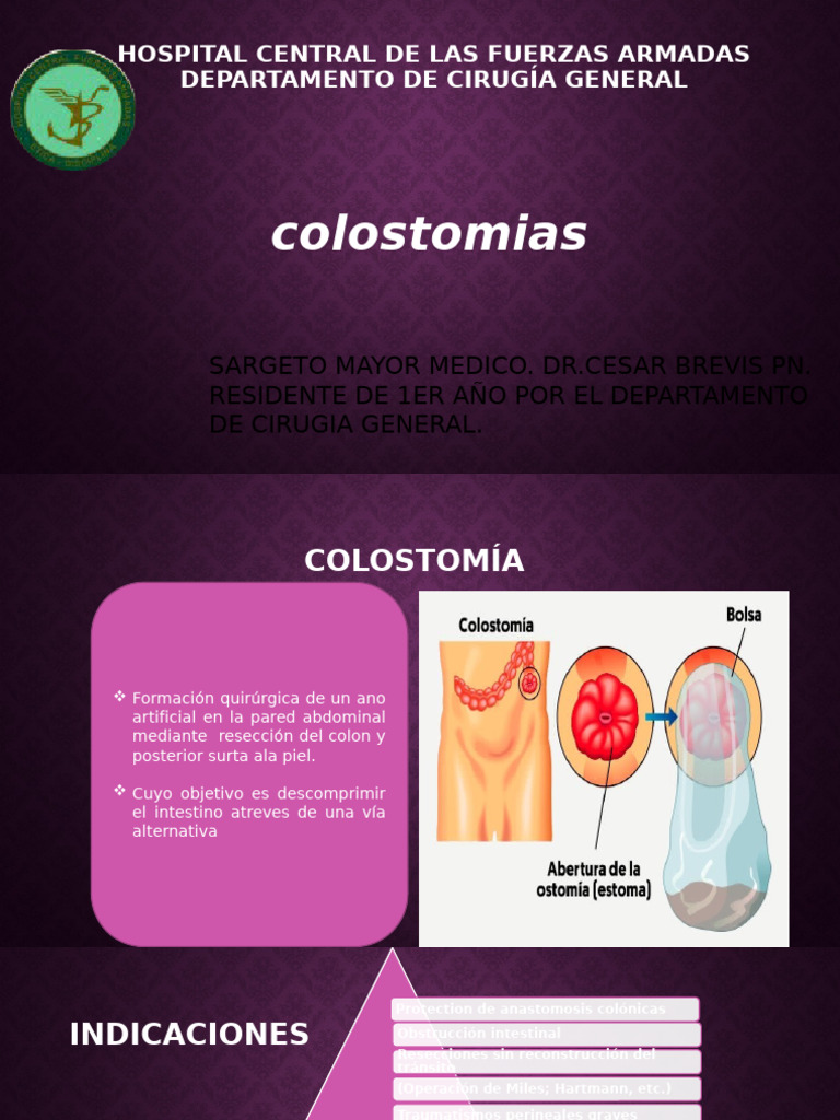 Tipos de Colostomia | PDF
