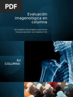 Clasificación de Pfirrmann Modificada | PDF | La columna vertebral ...