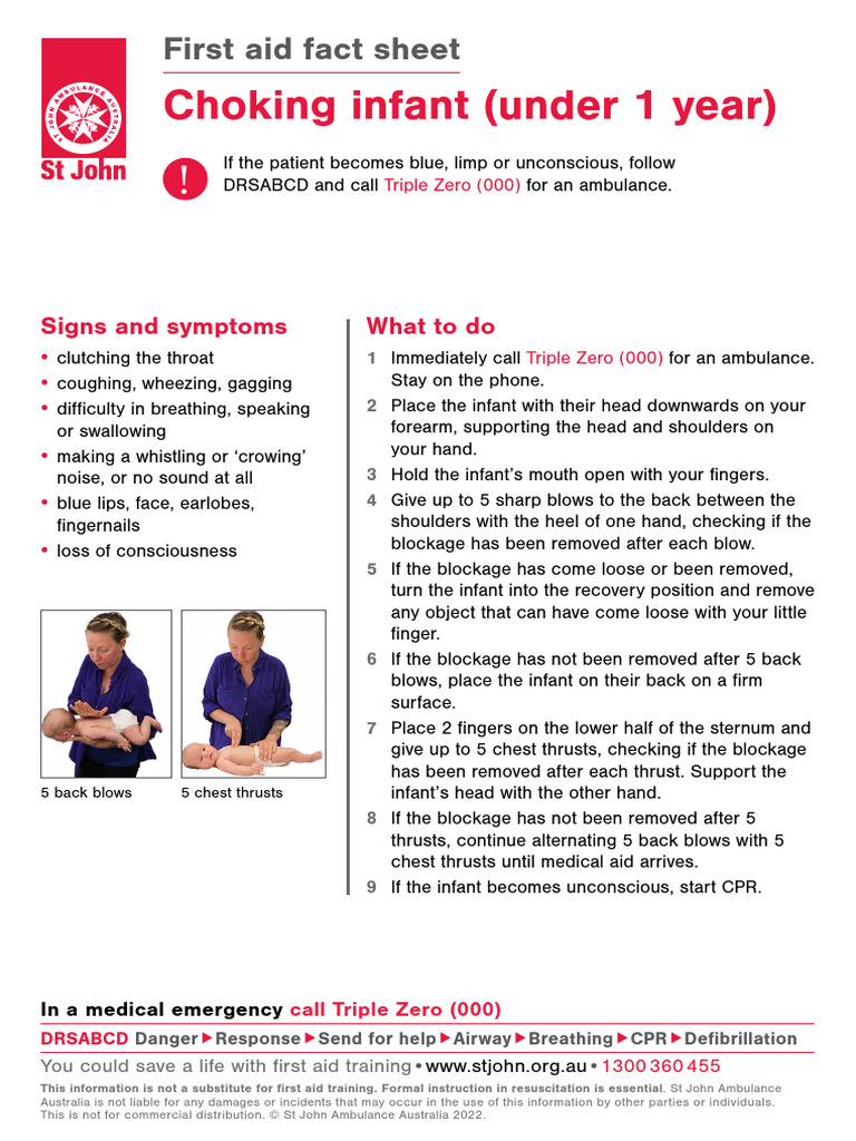 Baby Choking | PDF