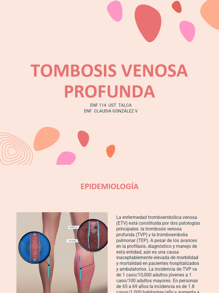Trombosis Venosa Profunda | PDF