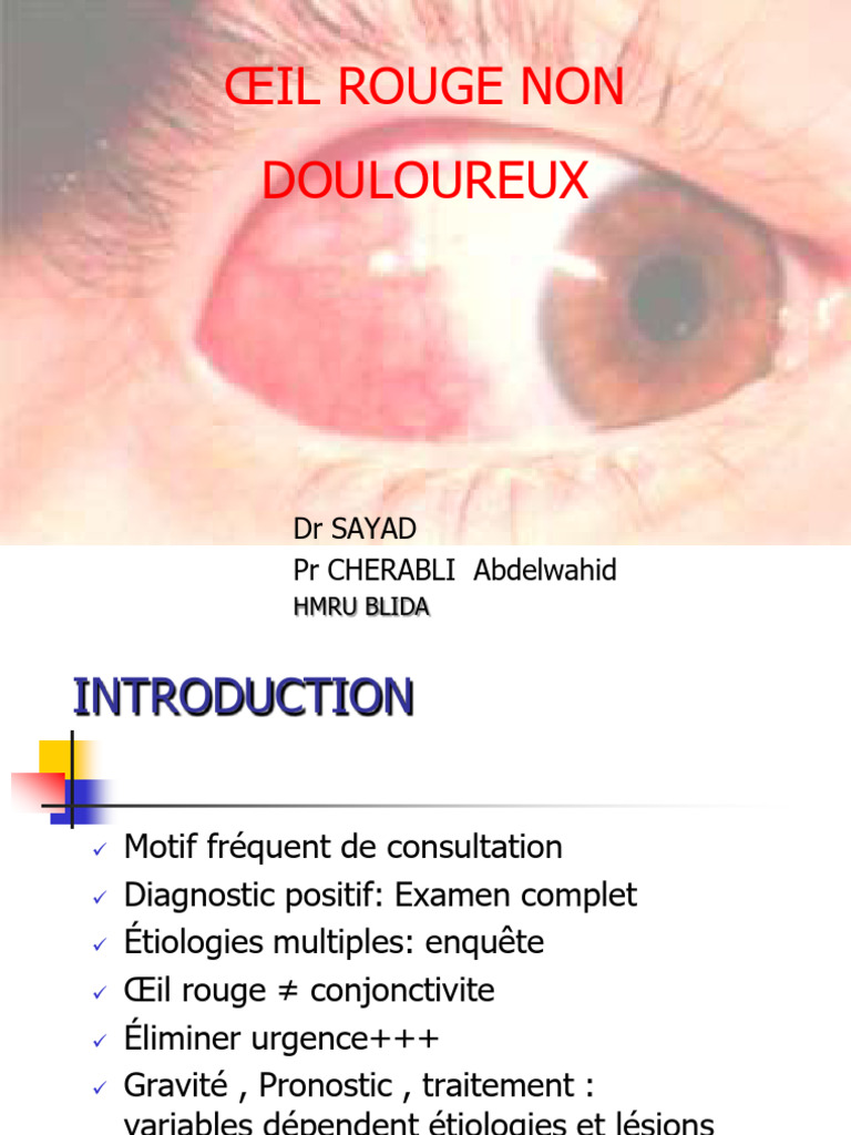 02 - (A) - Oeil Rouge Non Douloureux | PDF
