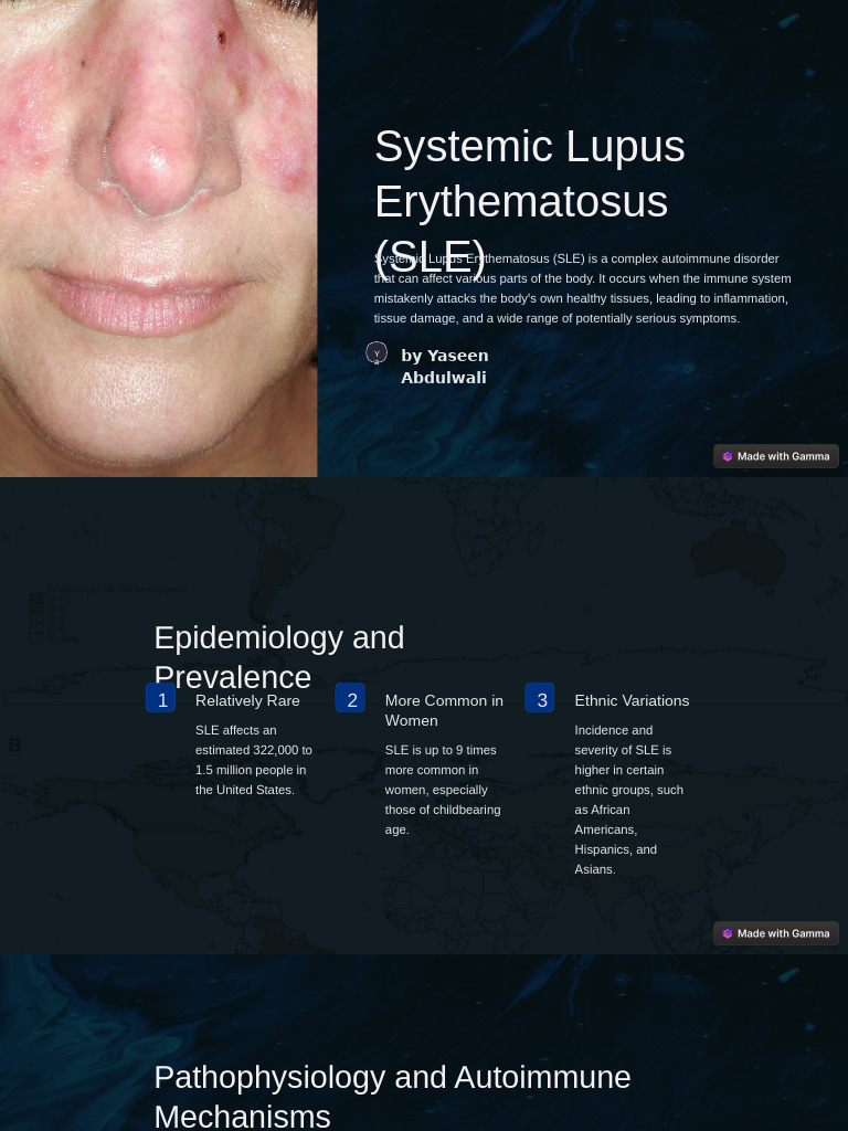 Systemic-Lupus-Erythematosus-SLE | PDF