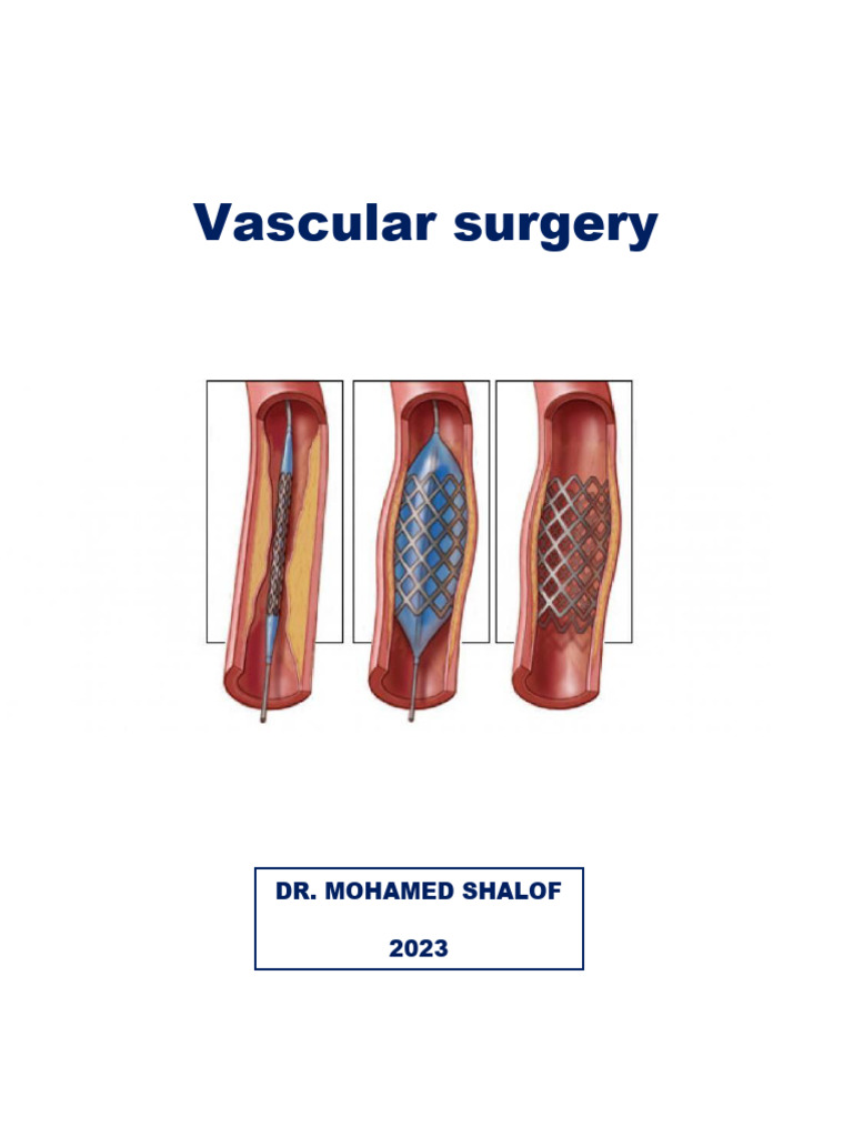 Vascular Surgery | PDF