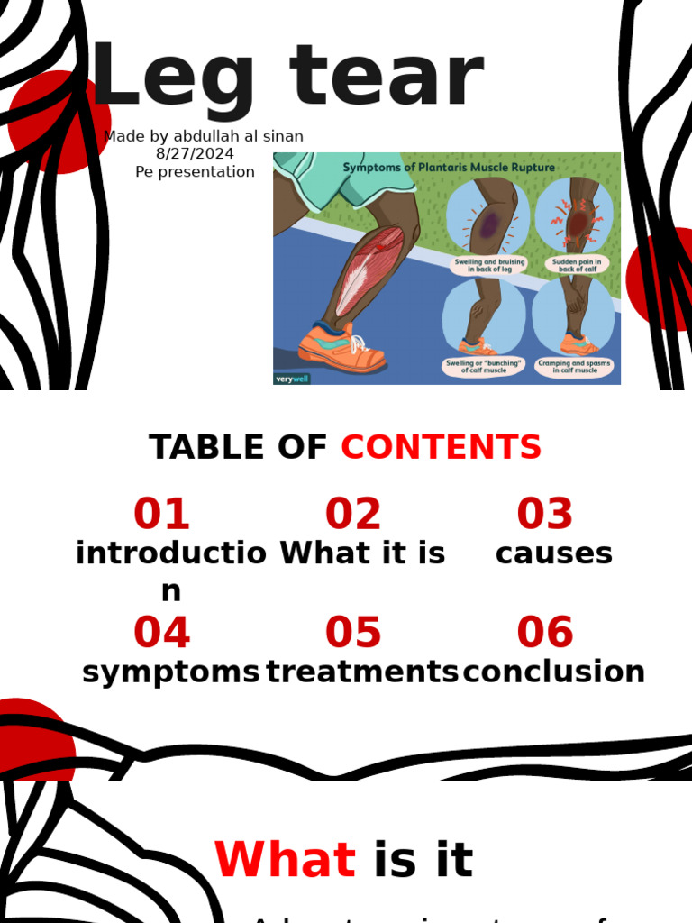 Leg Tear Pres | PDF