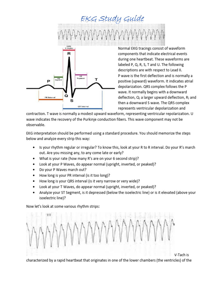 Ekg Quick Guide | PDF