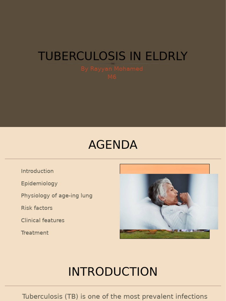 Tb in Elderly | PDF