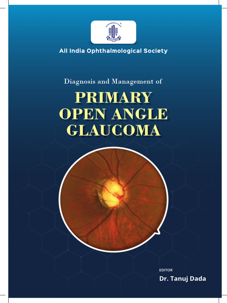 Primary Open Angle Glaucoma | PDF