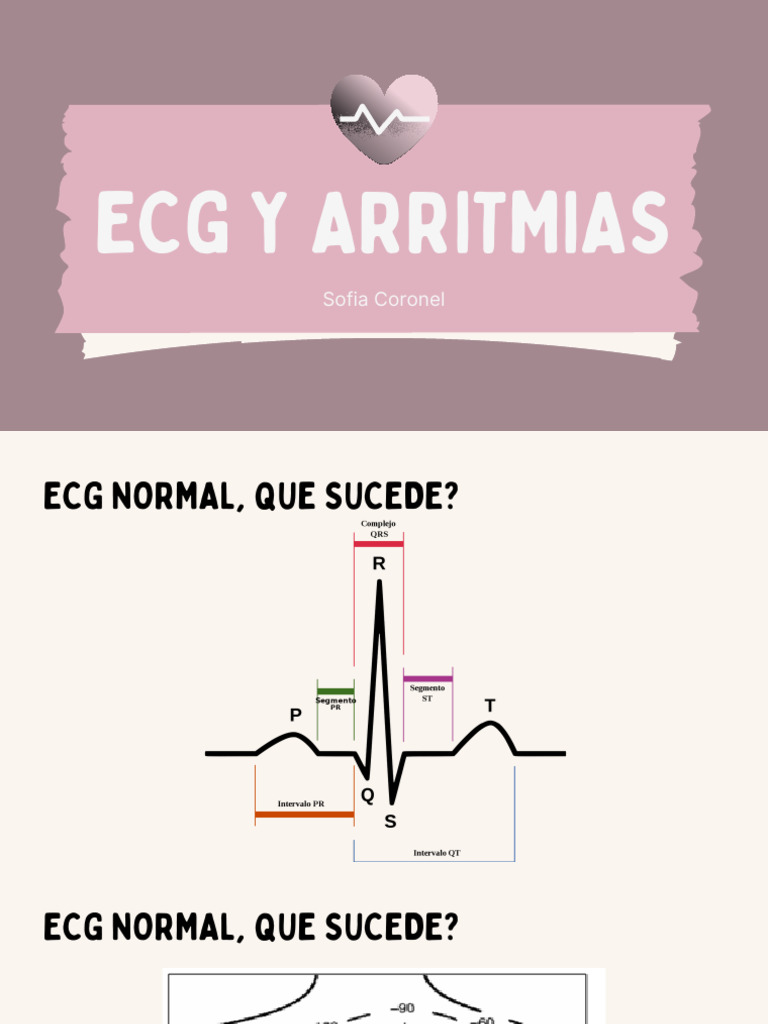 Ecg y Arritmias 1 | PDF
