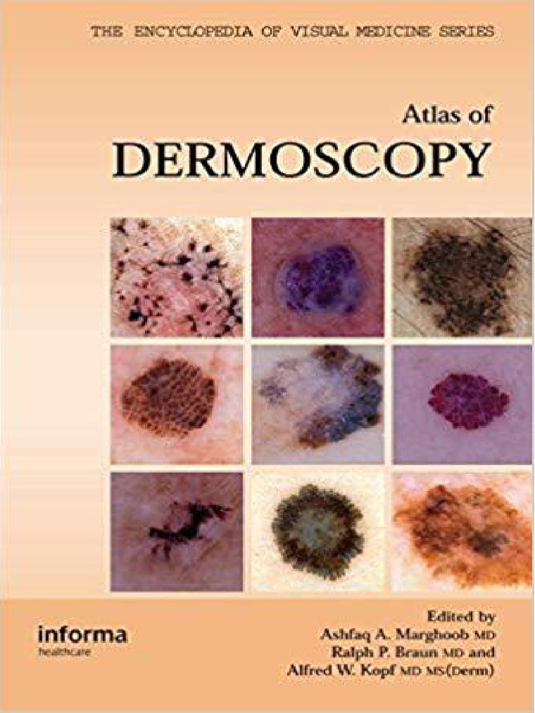 Atlas of Dermoscopy - Marghoob - 2004 | PDF