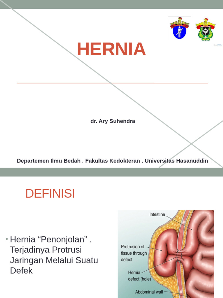 Hernias | PDF