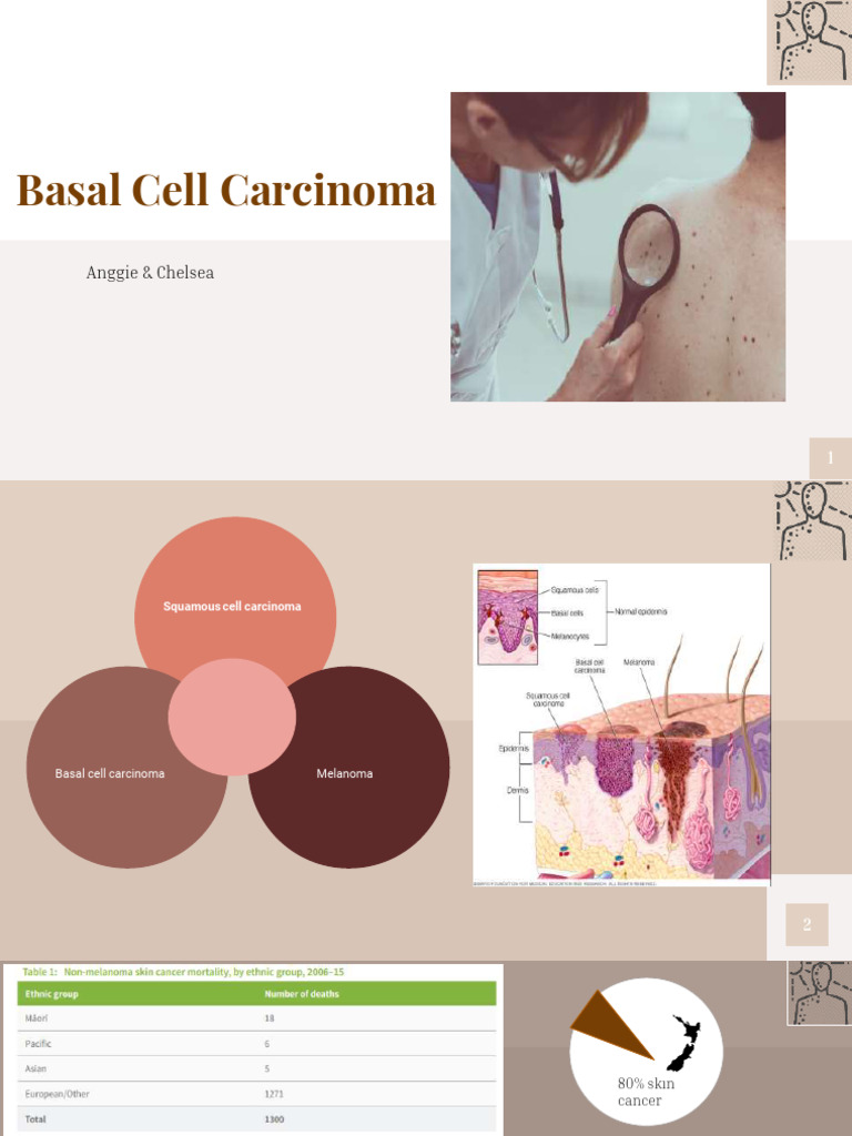 Basal Cell Carcinoma | PDF
