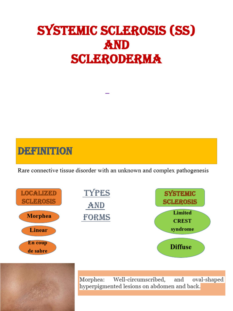 Systemic sclerosis (SS) | PDF