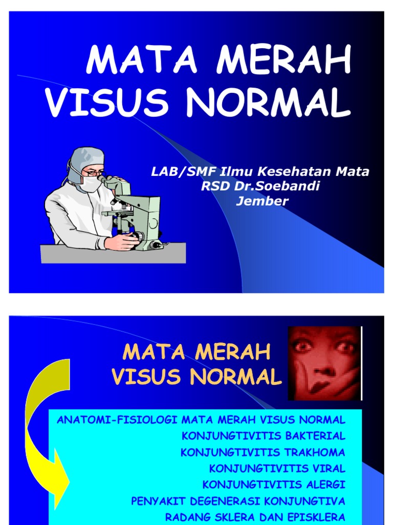 Kuliah II. S-I Mata Merah Visus Normal-BK | PDF