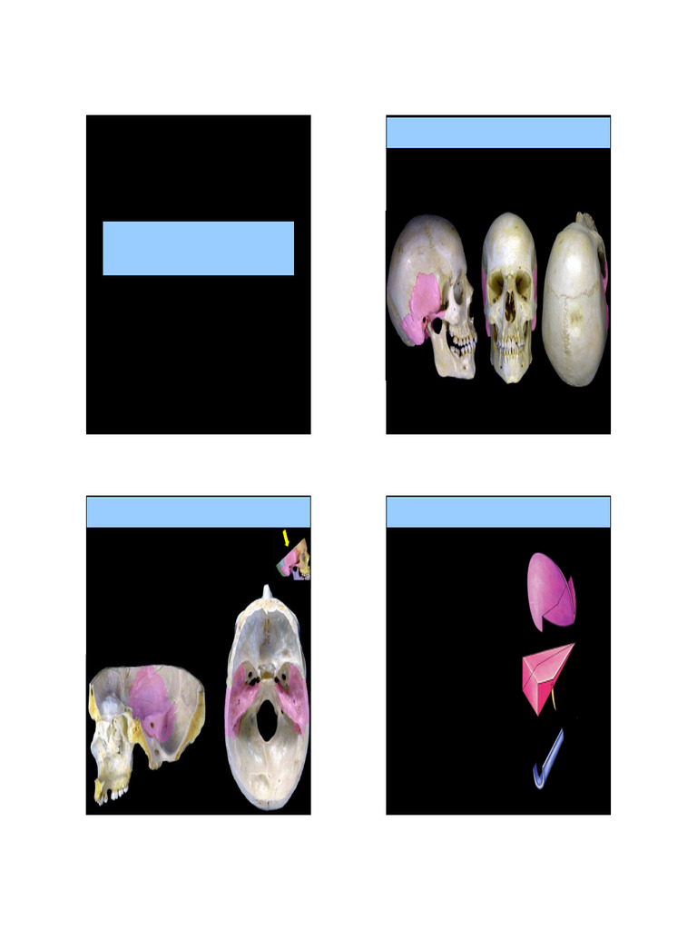 Jmg Anatomie Radiologique Du Rocher Des Paris | PDF