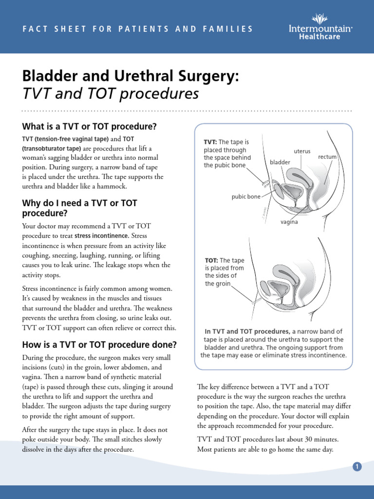 Bladder And Urethral Surgery TVT And TOT Procedures Fact Sheet | PDF