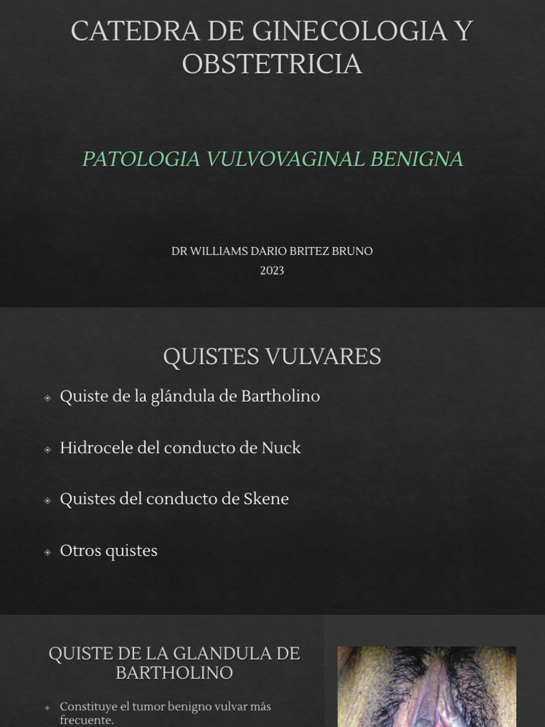 Aula 29 - Patología vulvovaginal benigna | PDF