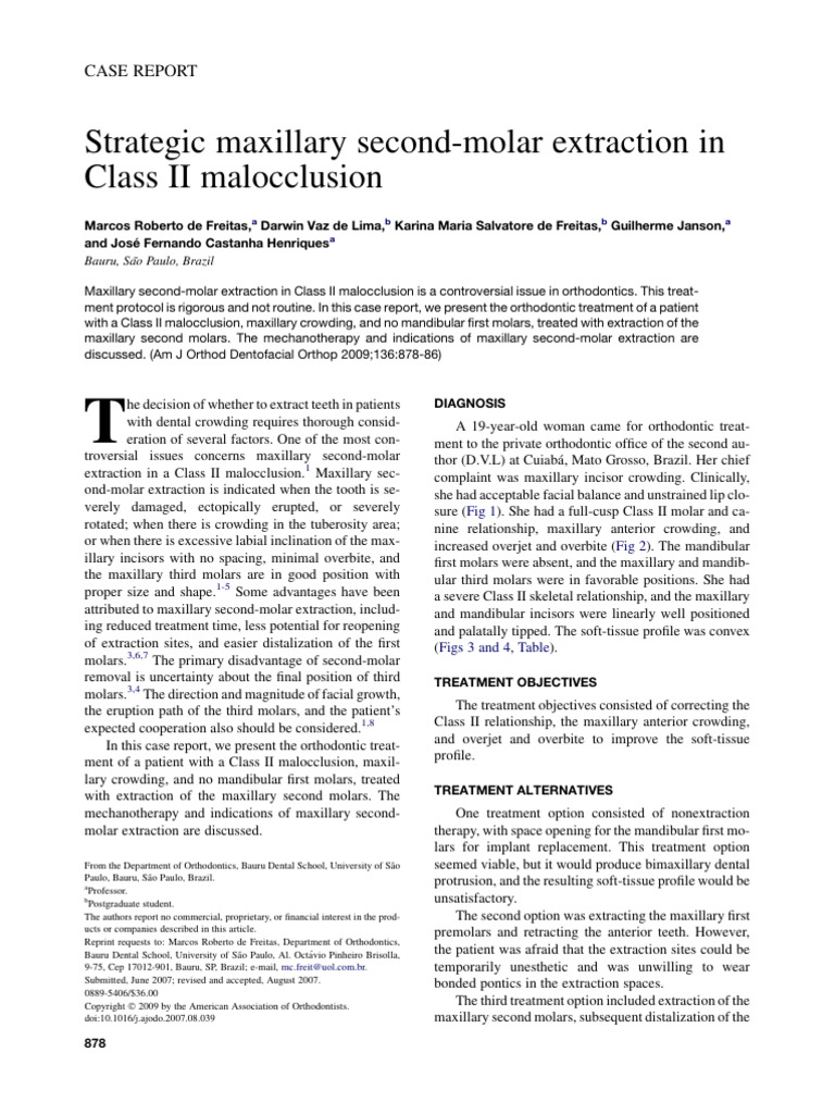 Strategic Maxillary Second-Molar Extraction in Class II Malocclusion | PDF