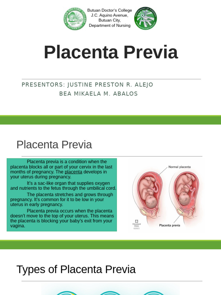 Placenta Previa 05-22-24 | PDF