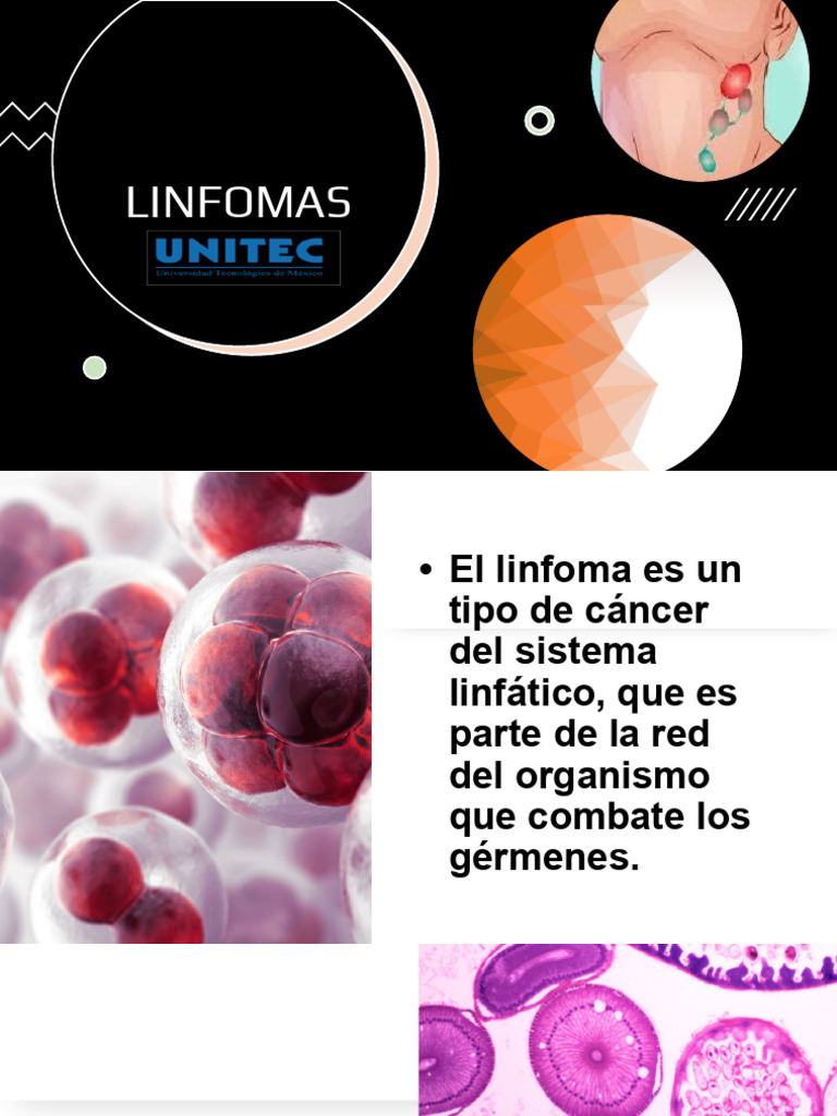 LINFOMA | PDF
