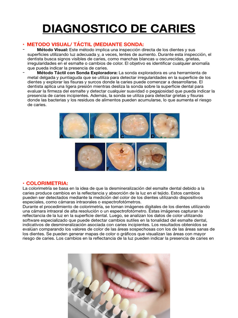 Act Ud 4 Caries | PDF