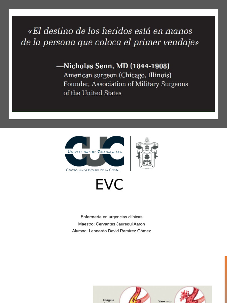 Evc | PDF