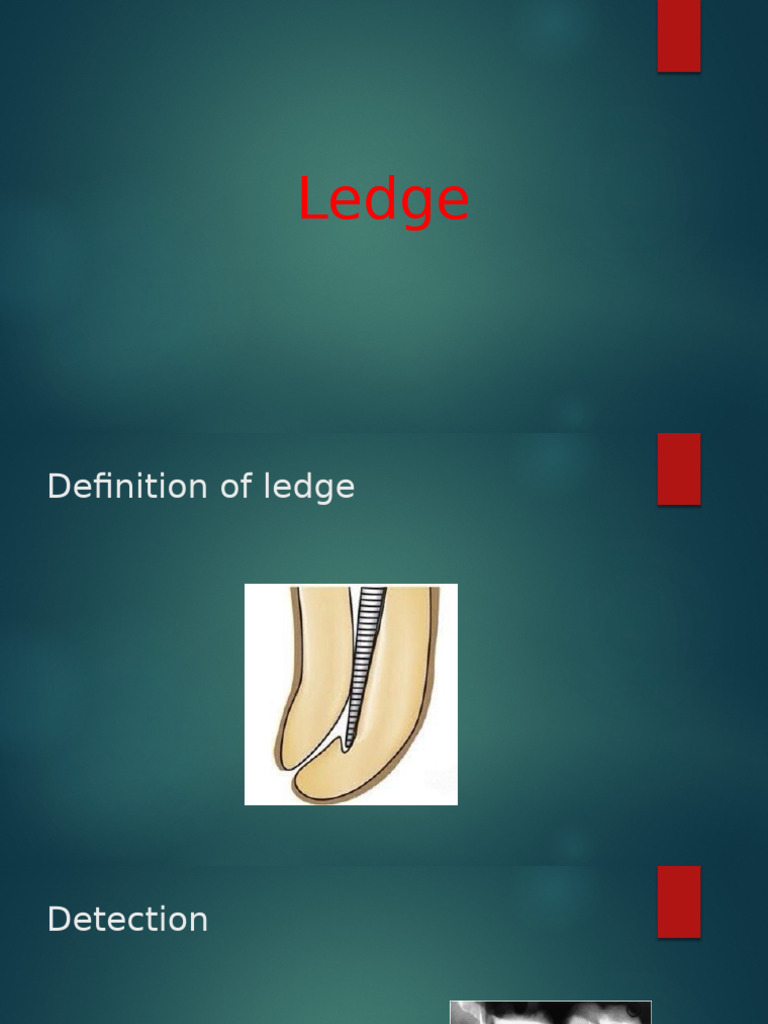 Ledge | PDF