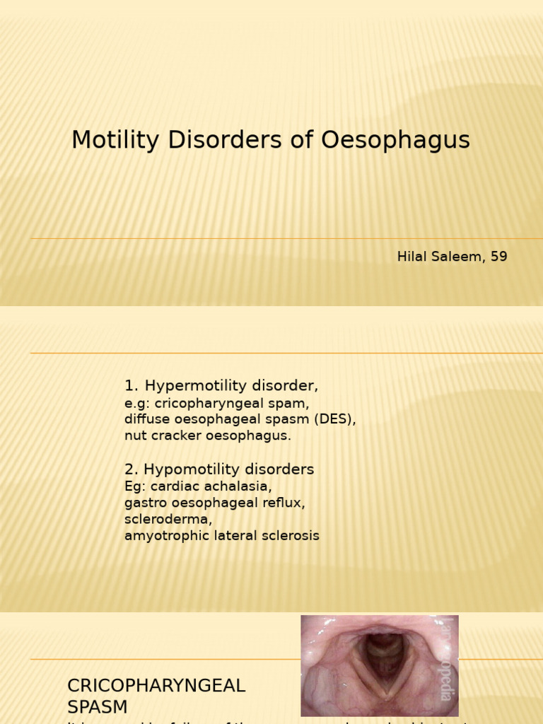 Motility Disorders of Esophagus | PDF | Esophagus | Gastroesophageal ...
