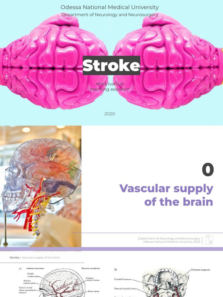 Stroke | PDF