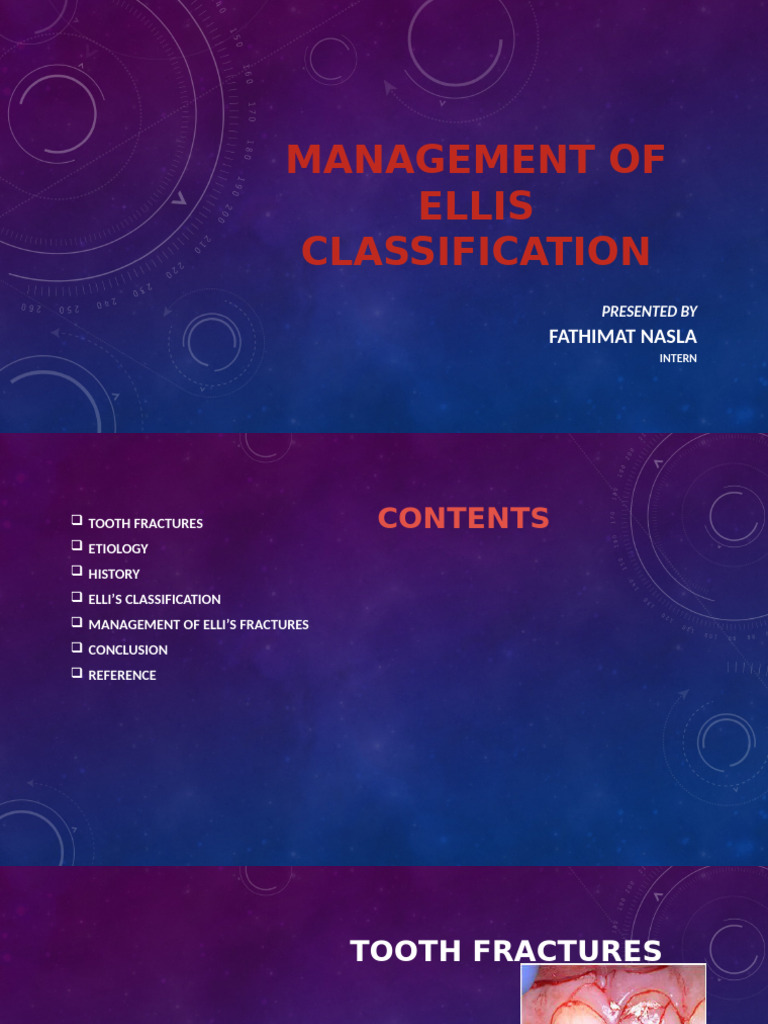 Nasla Ellis Classification | PDF