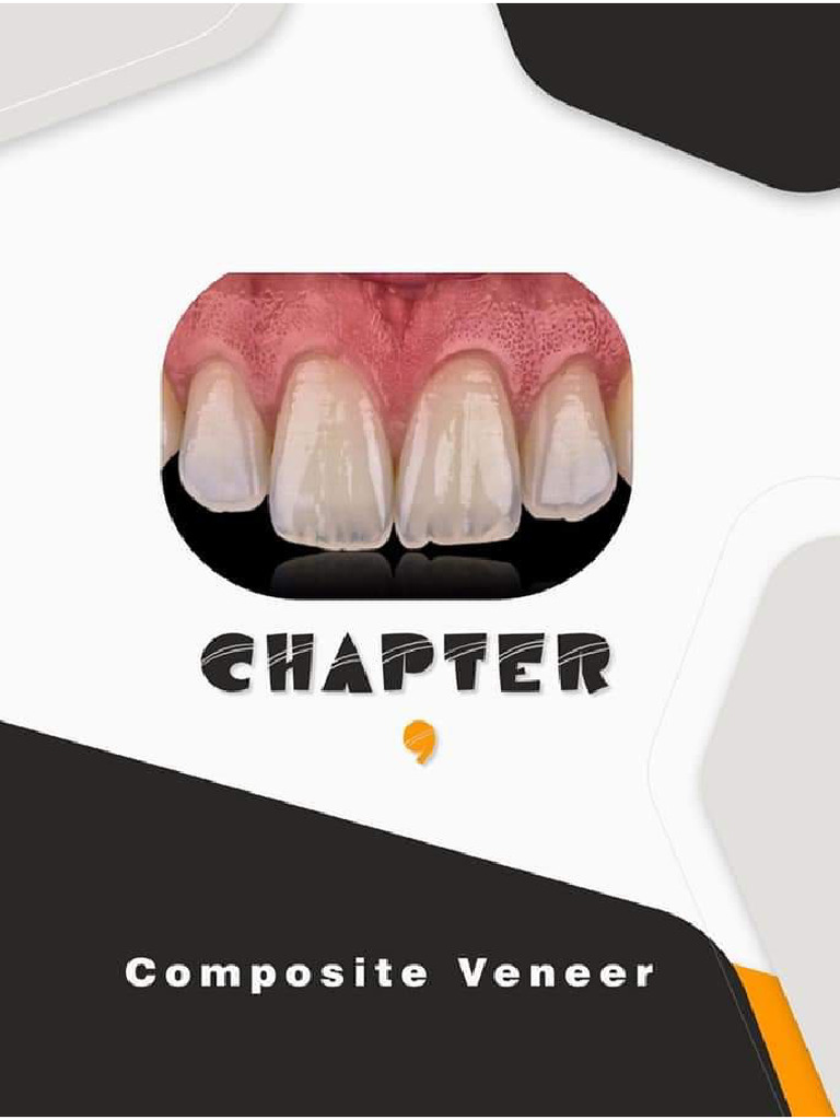 Composite Veneer | PDF