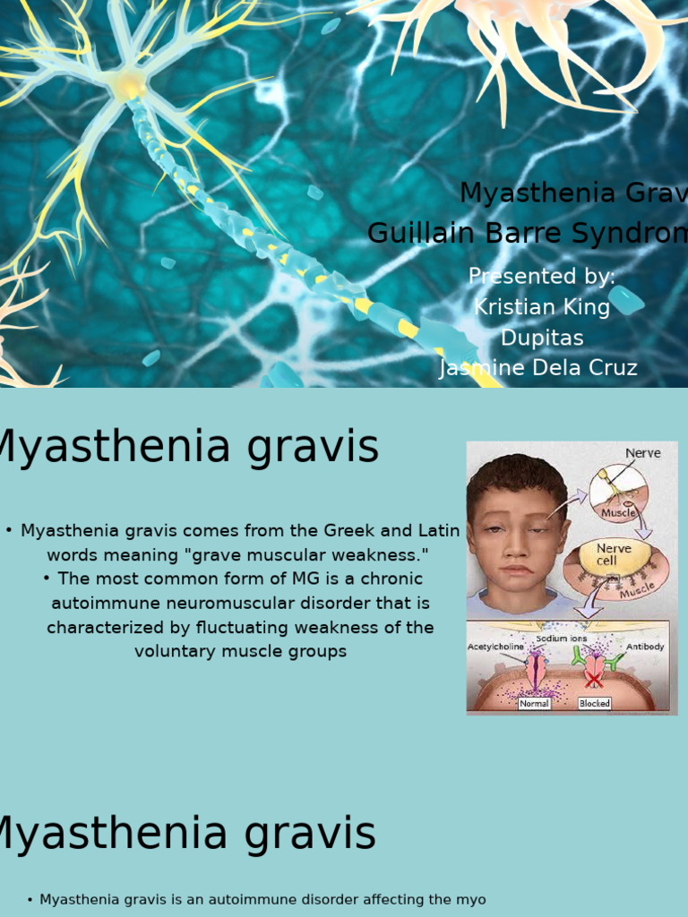Myasthenia Gravis Guillian Barre Syndrome - 20240830 - 111124 - 0000 | PDF | Neuromuscular ...