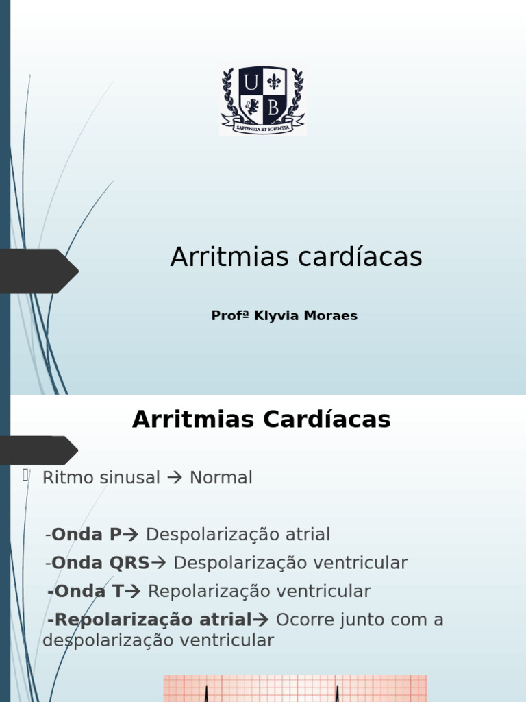 Arritimias Cardíacas - 4 | PDF