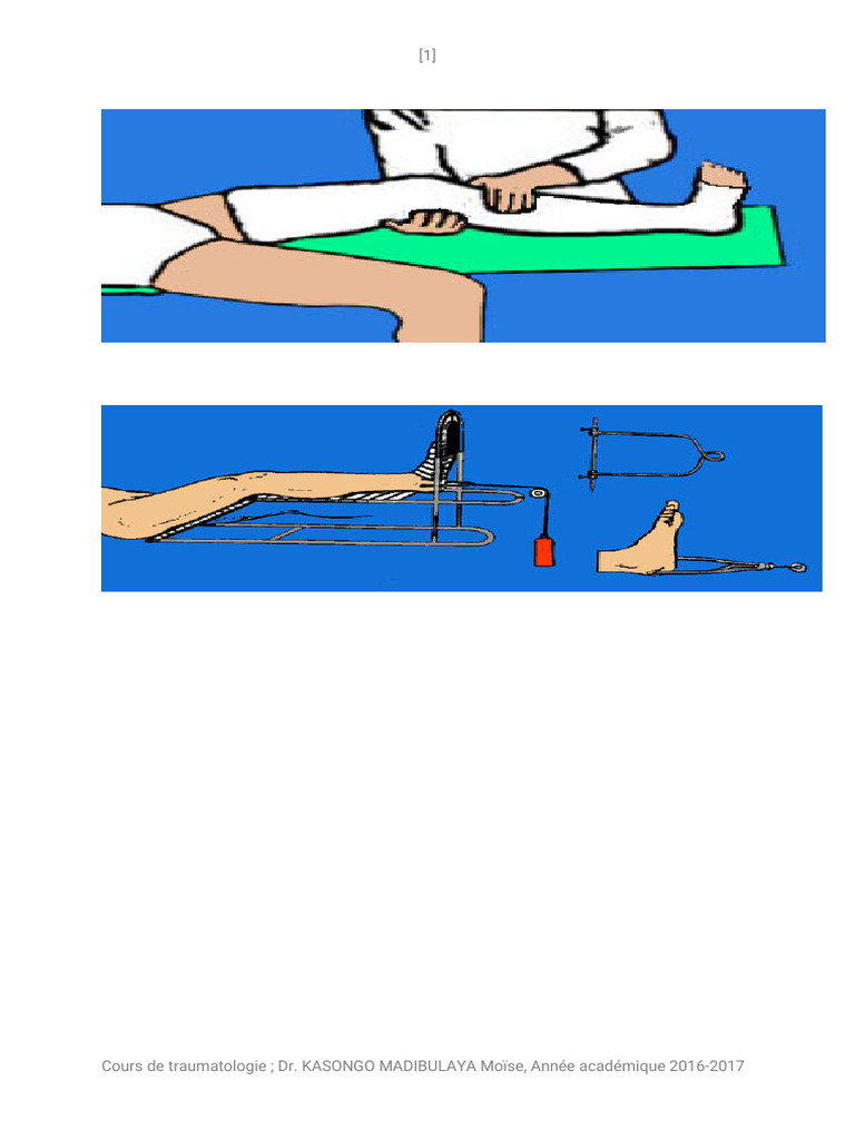 TRAUMATOLOGIE DR Kasongo | PDF
