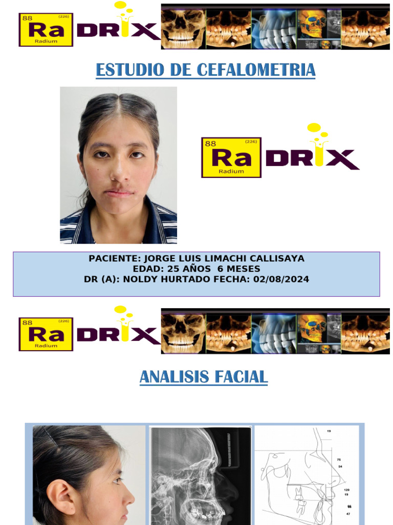 Plantilla Ratula Cefalometria | PDF