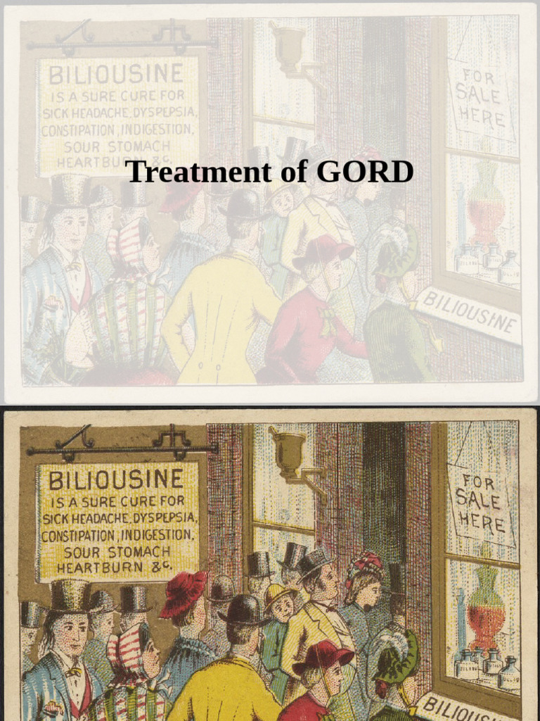 Treatment of GORD | PDF