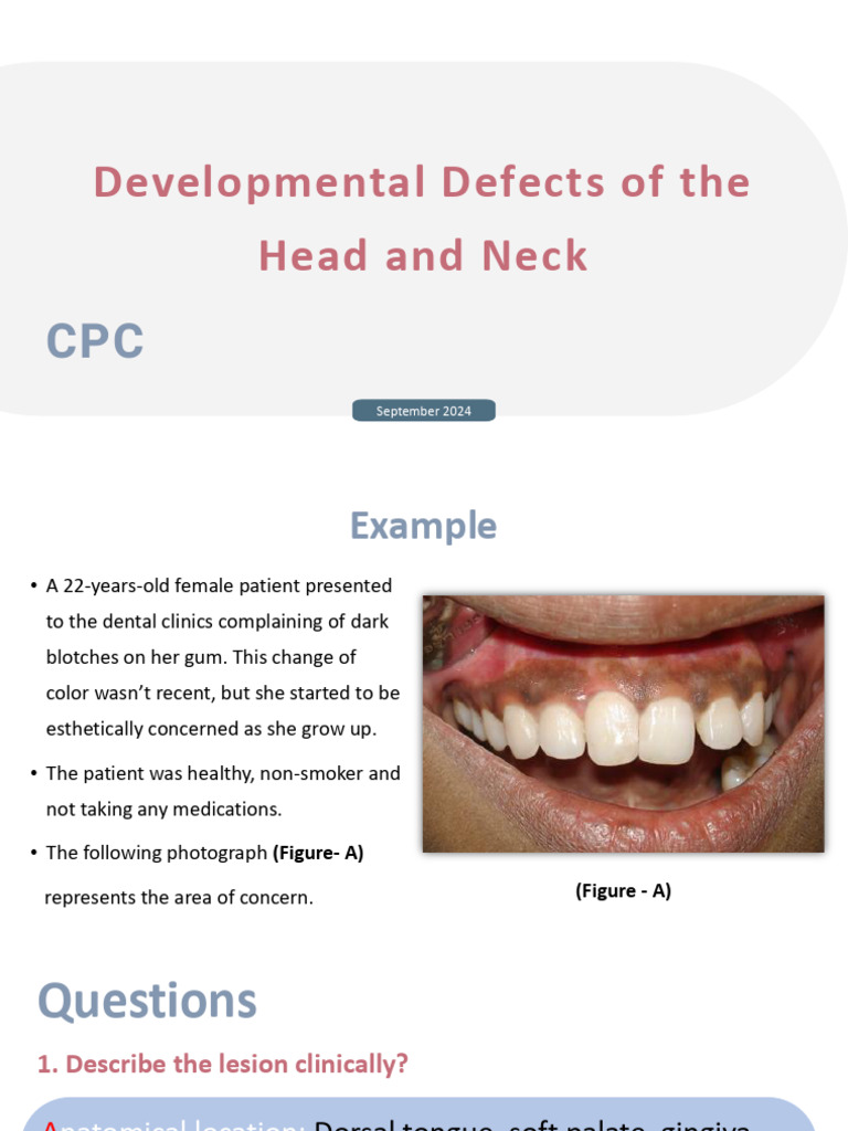Students CPC Developmental Defects of The Head and Neck Copy 6yt | PDF