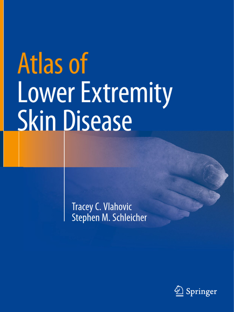 Atlas of Lower Limb Skin Diseases | PDF