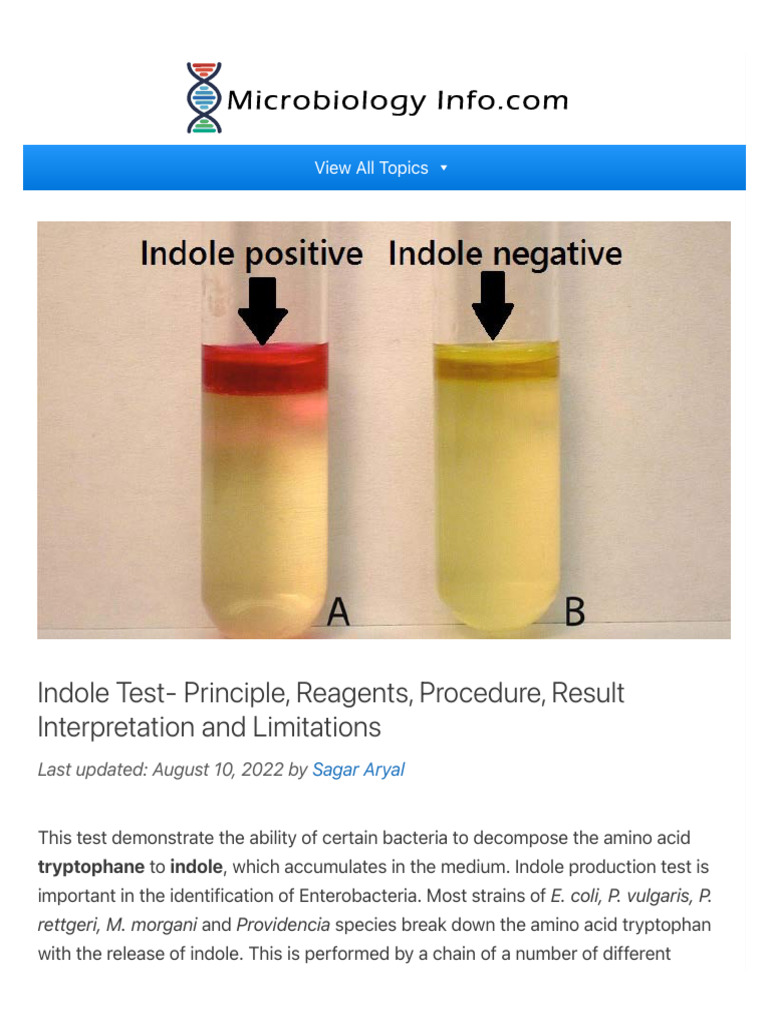 Indole Test - Principle, Reagents, Procedure, Resu | PDF