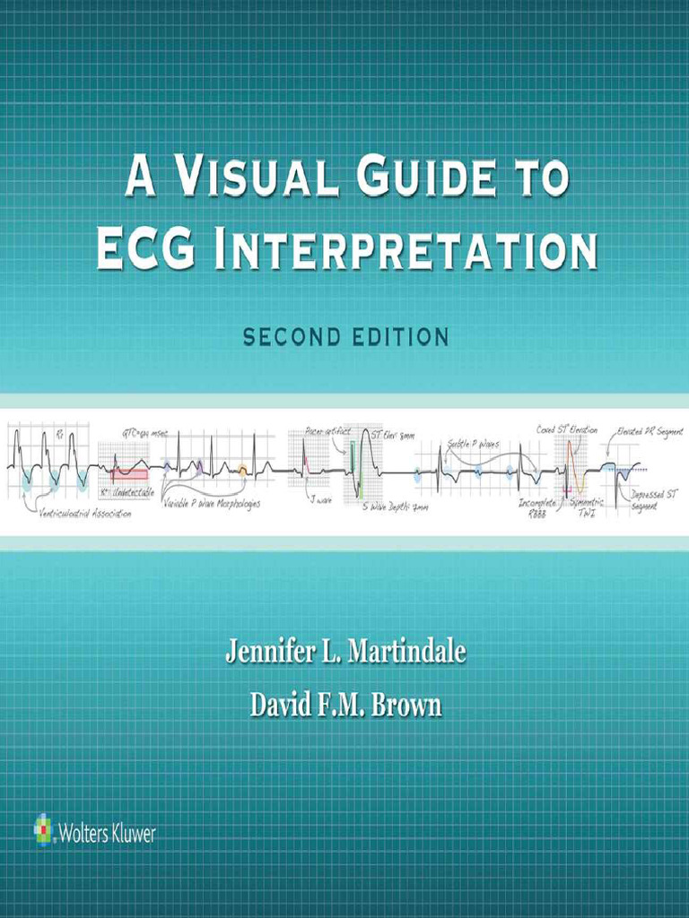 A Visual Guide To ECG Interpretation by Jennifer L. Martindale David F ...