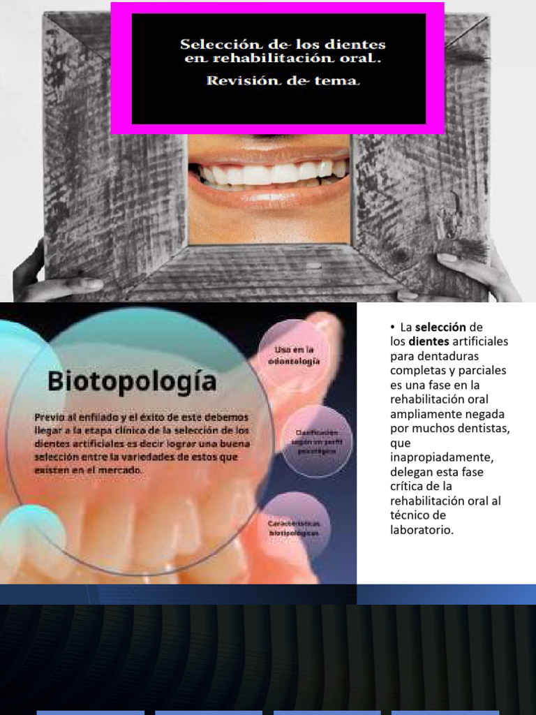 Presentación Selección de Los Dientes Artificiales 12022 | PDF
