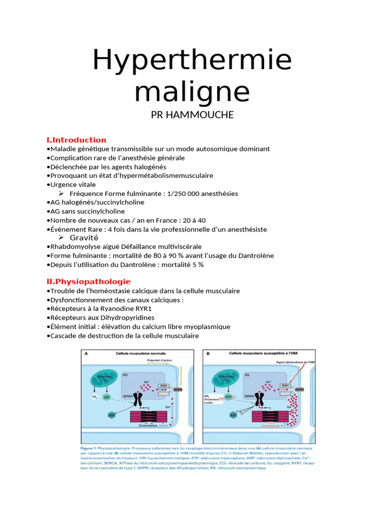 Hyperthermie Maligne | PDF