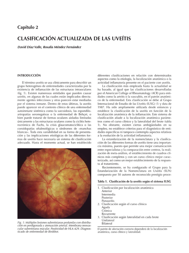 Cap 02 Clasificacion Actualizada de Las Uveitis | PDF