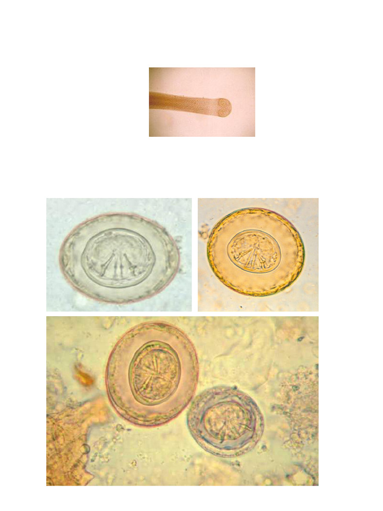 Hymenolepis diminuta | PDF