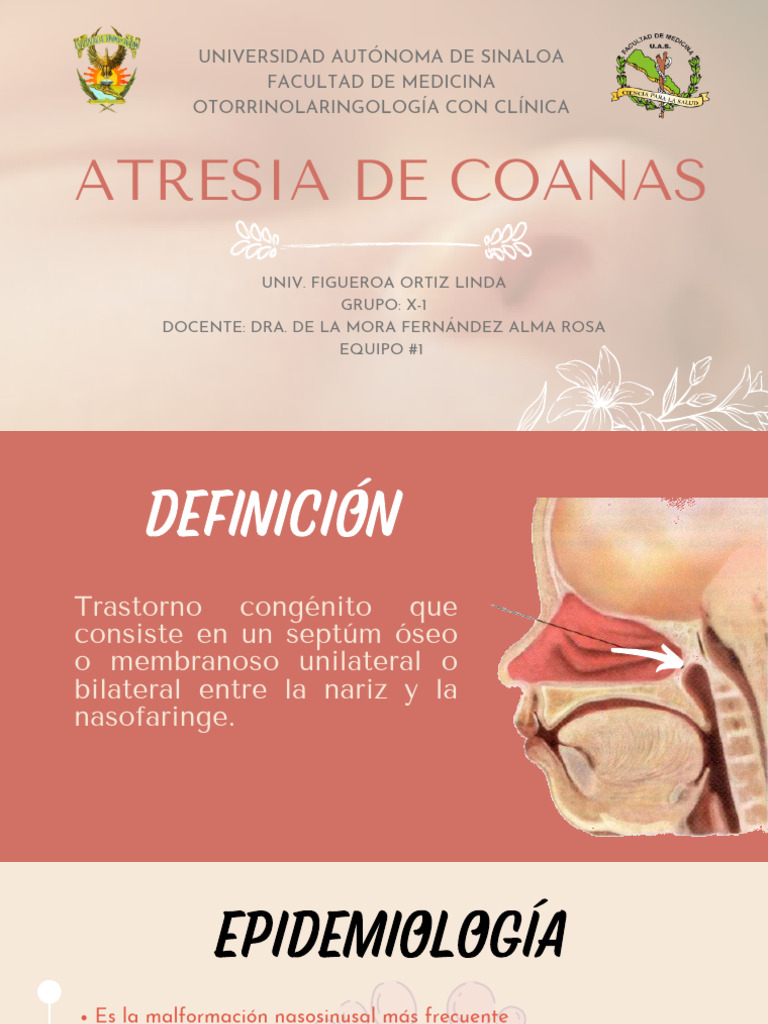 Atresia de Coanas | PDF